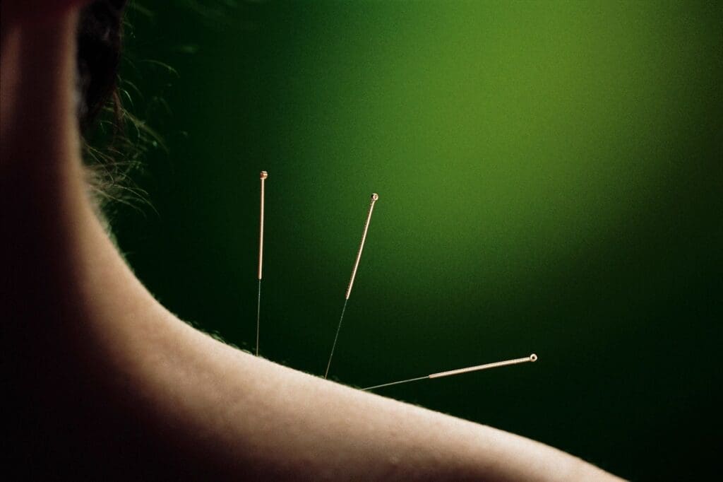 About - Acupuncture Services California - TAO OF MEDICINE